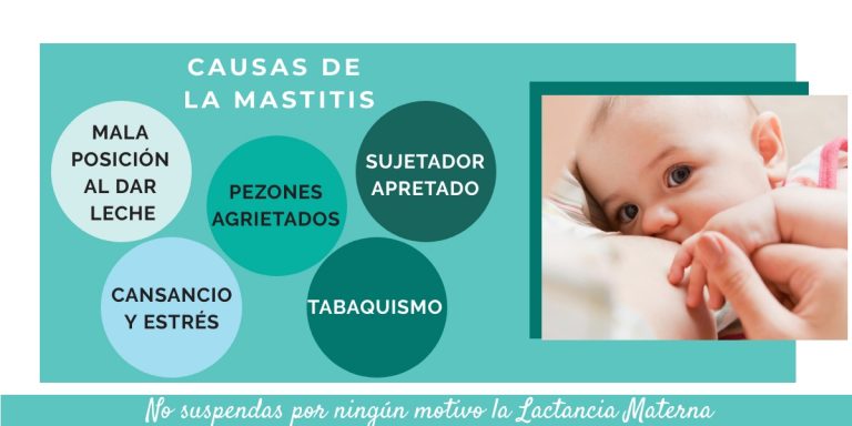 ¿Qué es mastitis? Síntomas y cómo curarla 【2019】