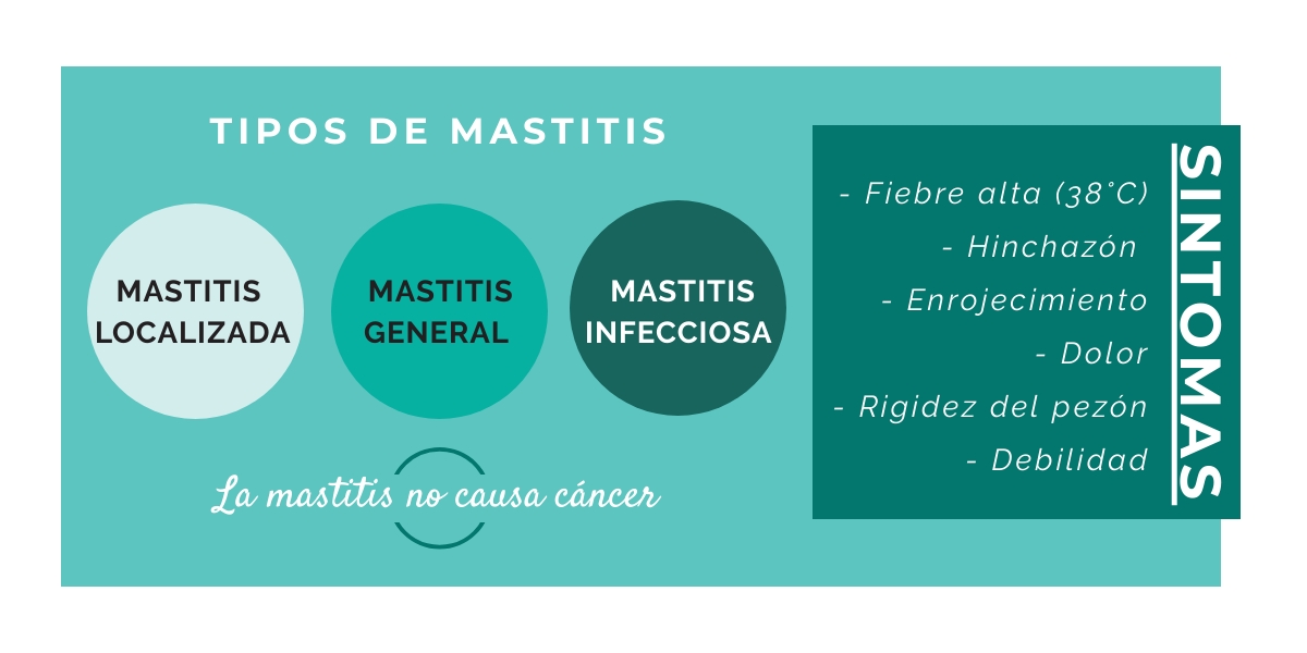 ¿Qué es mastitis? Síntomas y cómo curarla 【2019】